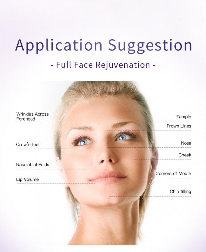 New Upgrade 1ml anti-wrinkle hyaluronic acid dermal lip filler injection